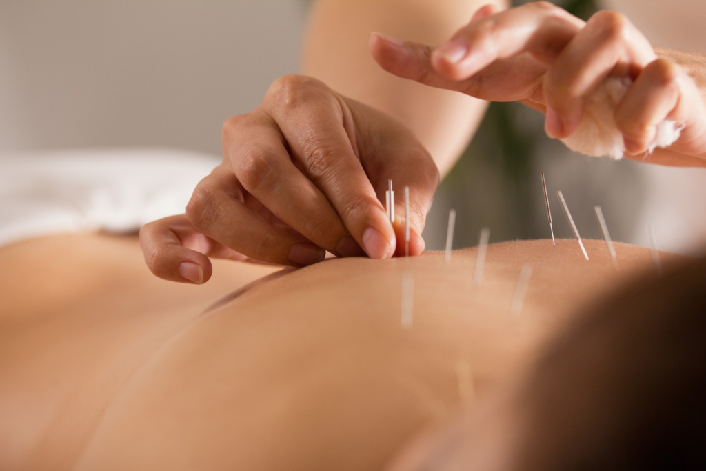 Japanese Acupuncture - Massage in Kyoto | Deep Tissue & Acupuncture ...